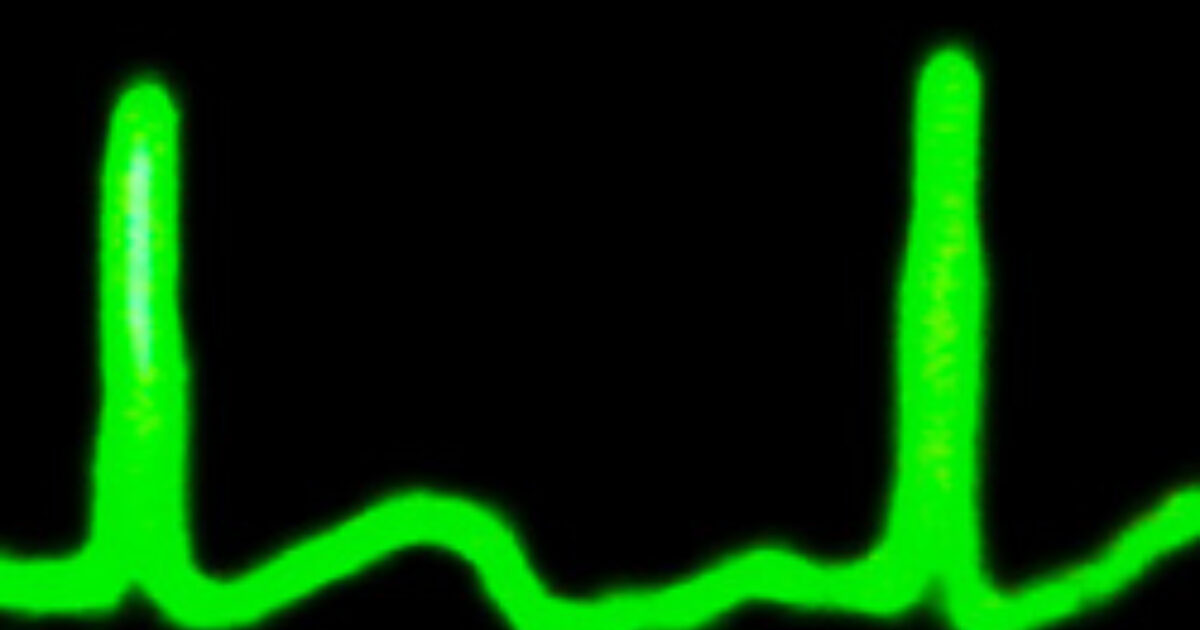 Lazarus Moments | Theology of Work